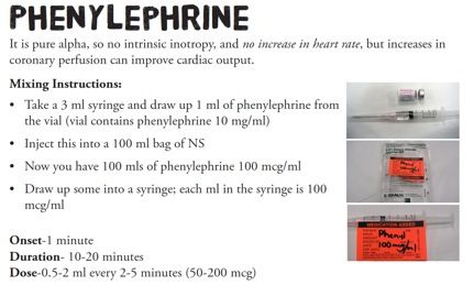 Pseudo PEA? When, How, What? | MEDEST